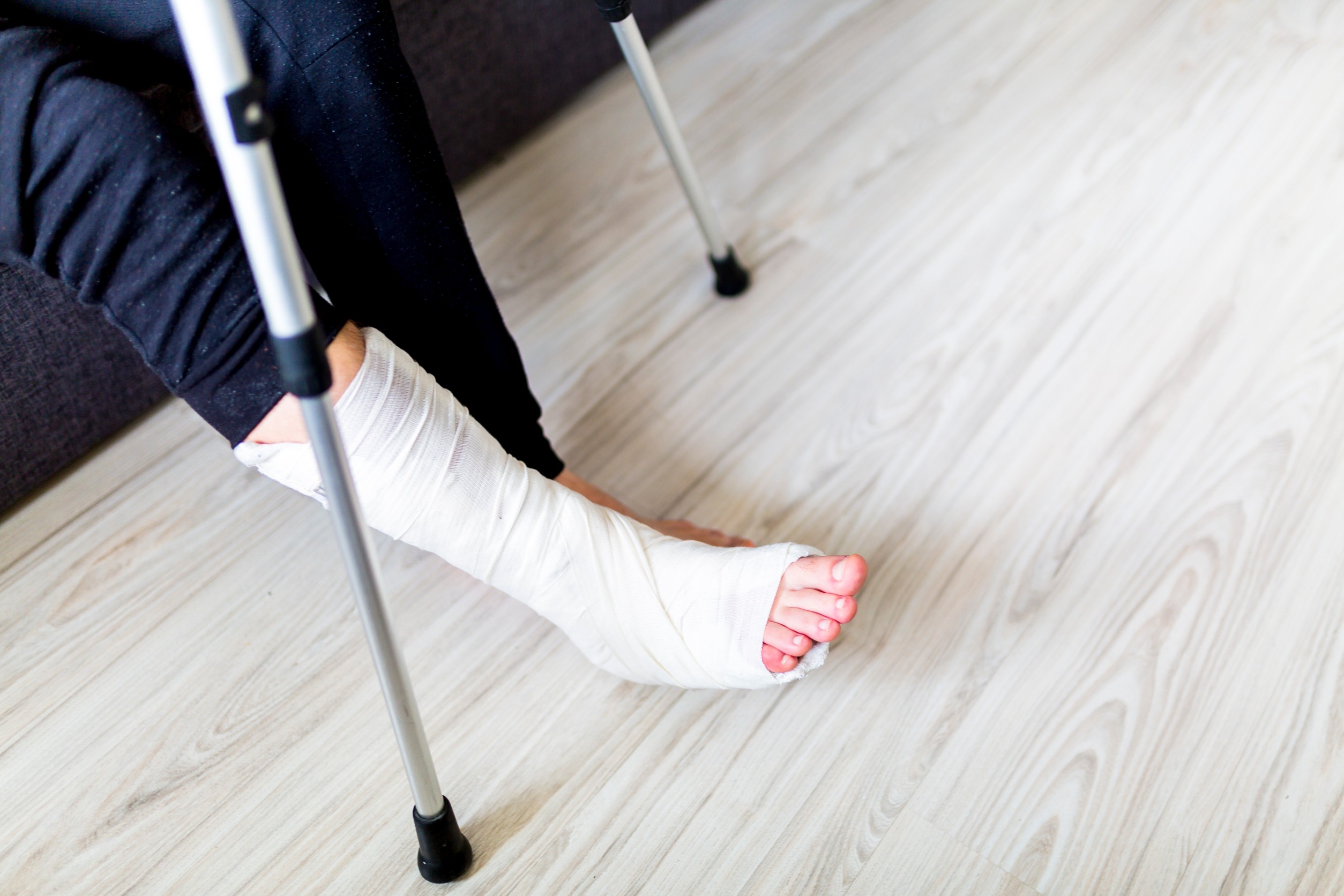 Broken Leg At Work Claim - How Much Compensation?